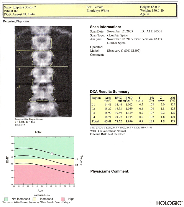 Osteoporosis The Imaging Center MRI CT X ray Ultrasound DEXA Fort